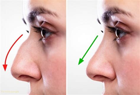 Different Nose Types