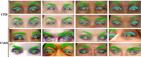 논문 리뷰 Open Source Periorbital Segmentation Dataset For Ophthalmic