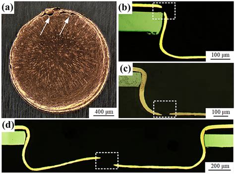Morphology Of The Fractured Joint A Global View Of A Typical Fractured