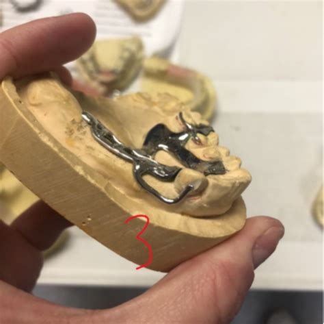 RPI Identification Exam Flashcards Quizlet RPI Identification Exam Flashcards Quizlet