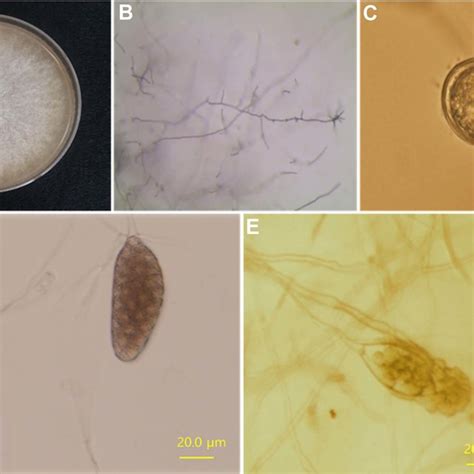 PDF Identification Of New Isolates Of Phytophthora Sojae And The Reactions Of Korean Soybean