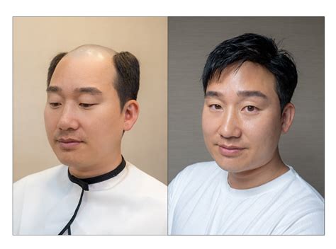 [남성맞춤가발] 내츄럴한 스타일의 남자가발