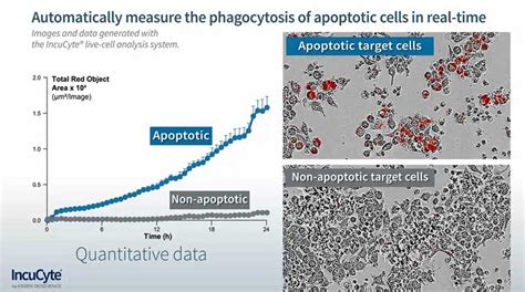 Incucyte® Live Cell Analysis Systems Selectscience