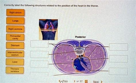 Texts Correctly Label The Following Structures Related To The Position