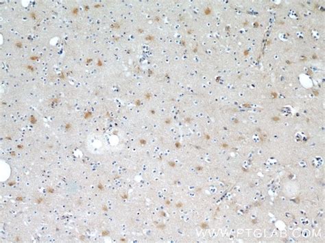 Eaat2 Rabbit Anti Human Mouse Rat Polyclonal Proteintech 150 μl
