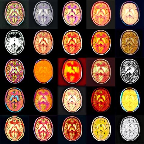 Micromacro Fusion By Michael Rullmann The Neuro Bureau