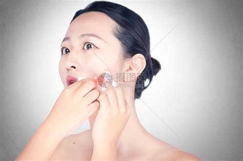 脸部祛痘图片素材 正版创意图片500737923 摄图网
