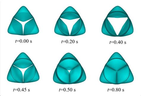 aortic valve opening and closing process in finite element numerical