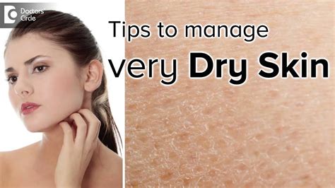 Dry Skin In All Seasons Causes And Its Management Dr Arti Priya R Youtube
