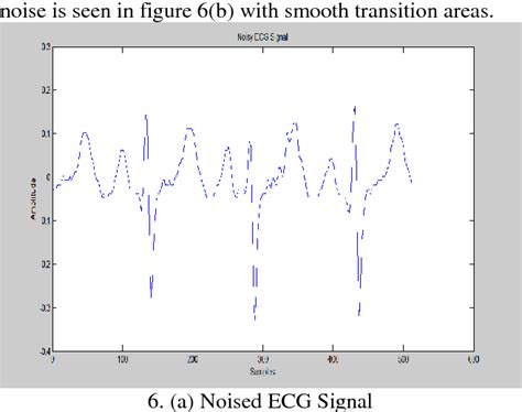 Table 1 From Analysis Of Ecg Signaling Using Wavelet Transform