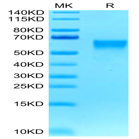Biotinylated Human B7 H4 Protein Bh7 Hm174b Kactus Biosystems Ushelf