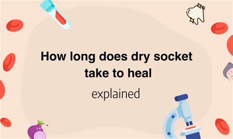 How Long Does Dry Socket Take To Heal