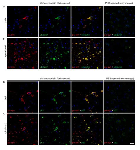 Bioluminescence Imaging Of Neuroinflammation In Transgenic Mice After Peripheral Inoculation Of