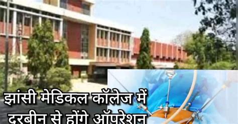 Good News झांसी मेडिकल कॉलेज में शुरू हुई दूरबीन से ऑपरेशन की सुविधा