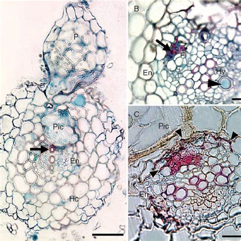 Transverse Sections Of The Red Clover Root In Stage S2 The Sections