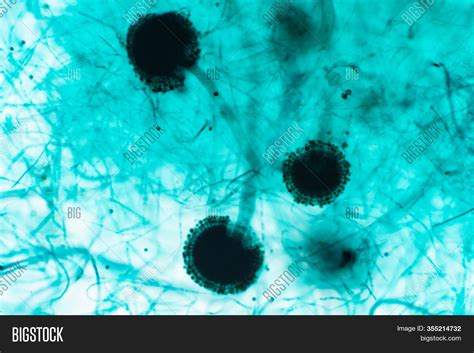 Aspergillus Microscopic