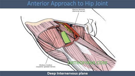 Anterior Approach To Hip Joint Easily Explained Orthofixar
