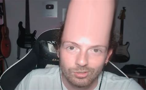 O Andre Falou Que Tem A Testa Grande Mas Até Que é Pequena Randreyoung