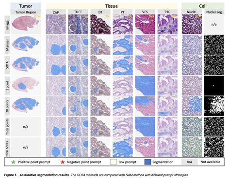 Segment Anything Model Sam For Digital Pathology Assess Zero Shot Segmentation On Whole Slide