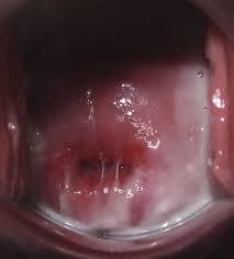 Physiologic Changes Flashcards Quizlet