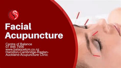 Facial Acupuncture Best Acupuncture Hamilton Nz