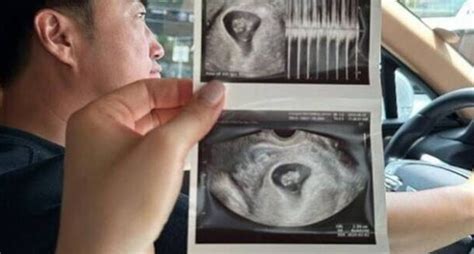 끝나고모여 장동민 부모 아빠 아버지 장광순 어머니 자녀 가족 아이