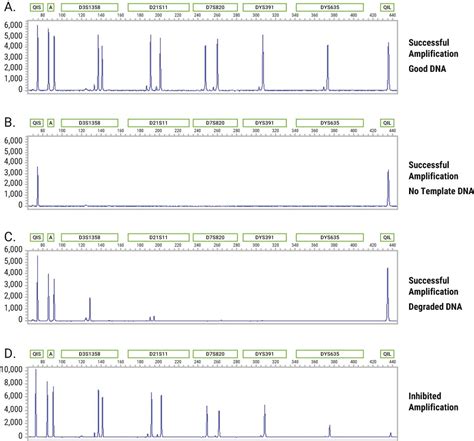 Powerplex® 18e System America Volume 7 Spring 2023