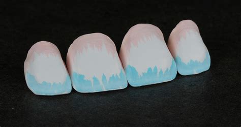 A Guide To Perfectly Polished Composite Restorations