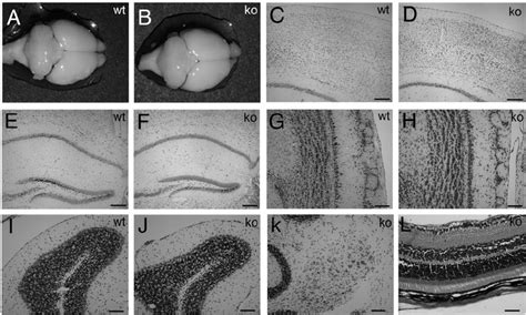 Histology Of Wild Type And Knockout Adult Brains Macroscopic Analysis