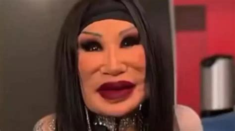 “მეგობრებმა სახე დაუმახინჯეს“ ღალატისა და თაღლითობის მსხვერპლი ულამაზესი მსახიობის ისტორია