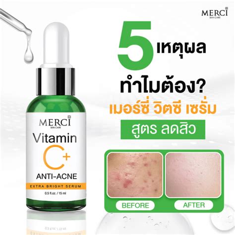 5 เหตุผล ทำไมต้อง “เมอร์ซี่ เซรั่ม สูตรลดสิว” Merci Skincare