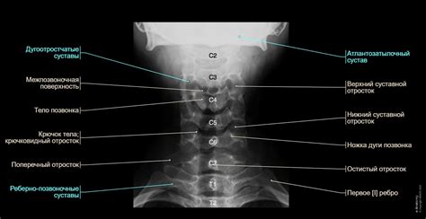 Позвоночник рентгенограммы нормальная анатомия E Anatomy