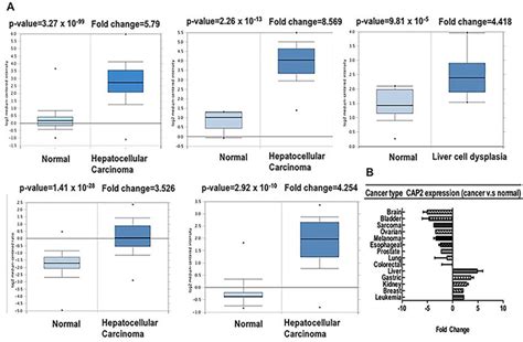 Cap2 Analysis In Different Cancer Types Oncomine Database The Box
