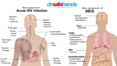 Aids Symptoms