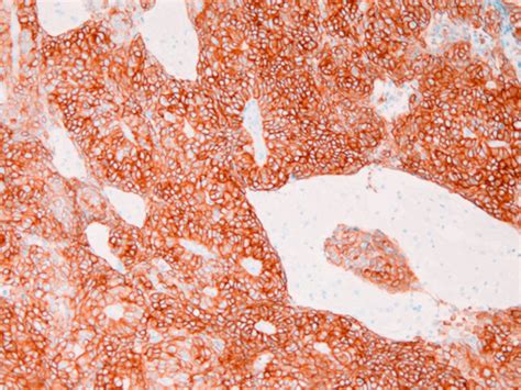 Cytokeratin 7 Is Strongly Expressed In The Cytoplasm Of The Brain Download Scientific Diagram