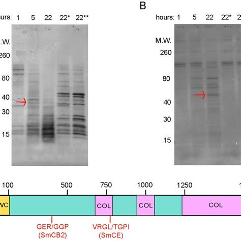 Ck Isoenzyme Electrophoresis Of Sera Incubated With Various Antisera