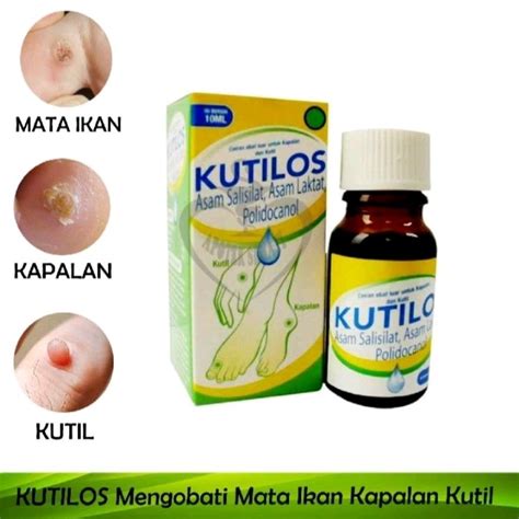 Jual Kutilos 10ML Obat Kutil Kapalan Dan Mata Ikan Shopee Indonesia