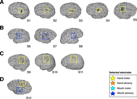 Ecog Grid Localization Ad Brain Surface Renderings With Projected