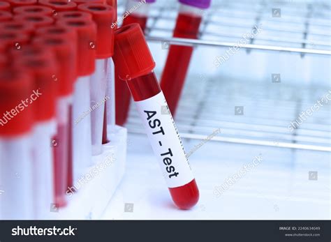 Ast Test Look Abnormalities Blood Blood Stock Photo Shutterstock