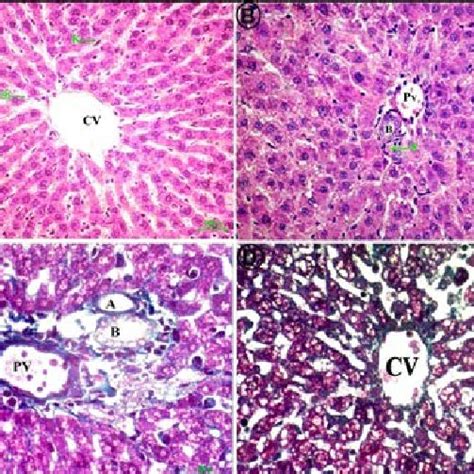 A Liver Of Control Rat Showing A Hepatic Lobule With Central Vein