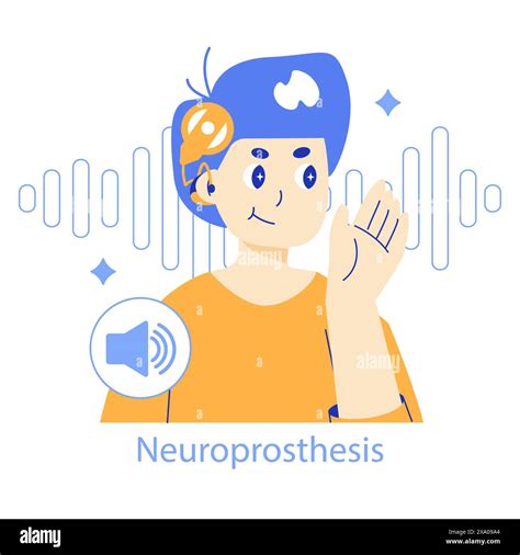 Neuroprosthesis Concept A Vibrant Vector Illustration Capturing The Integration Of Advanced
