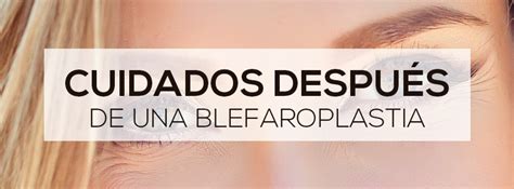 Todo sobre los cuidados después de una blefaroplastia