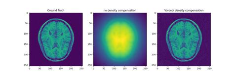 Density Compensation Routines Mri Nufft Documentation