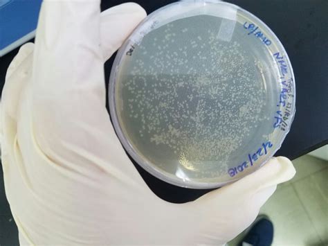 21 Questions With Answers In Yeast Identification Science Topic