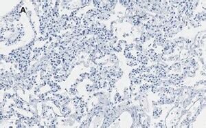 抗整合素αVβ 6抗体克隆10D5无叠氮化物 clone 10D5 Chemicon from mouse Sigma Aldrich