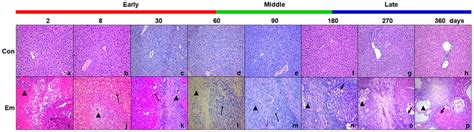 Representative Histopathology Of Mice Liver During E Multilocularis