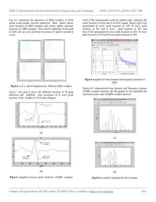 Wavelet Transform Based On Qrs Detection Using Diodic Algorithm Pdf