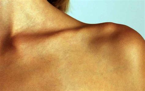 Collarbone Pain Health And Medical Articles Hellomrdoctor