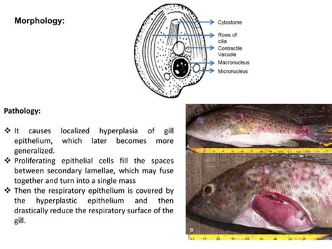 Life Cycle Of Protozoan Parasite Pptx