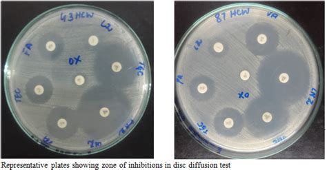 Screening Of Multi Drug Resistant Staphylococcus Aureus Mdr Sa Using